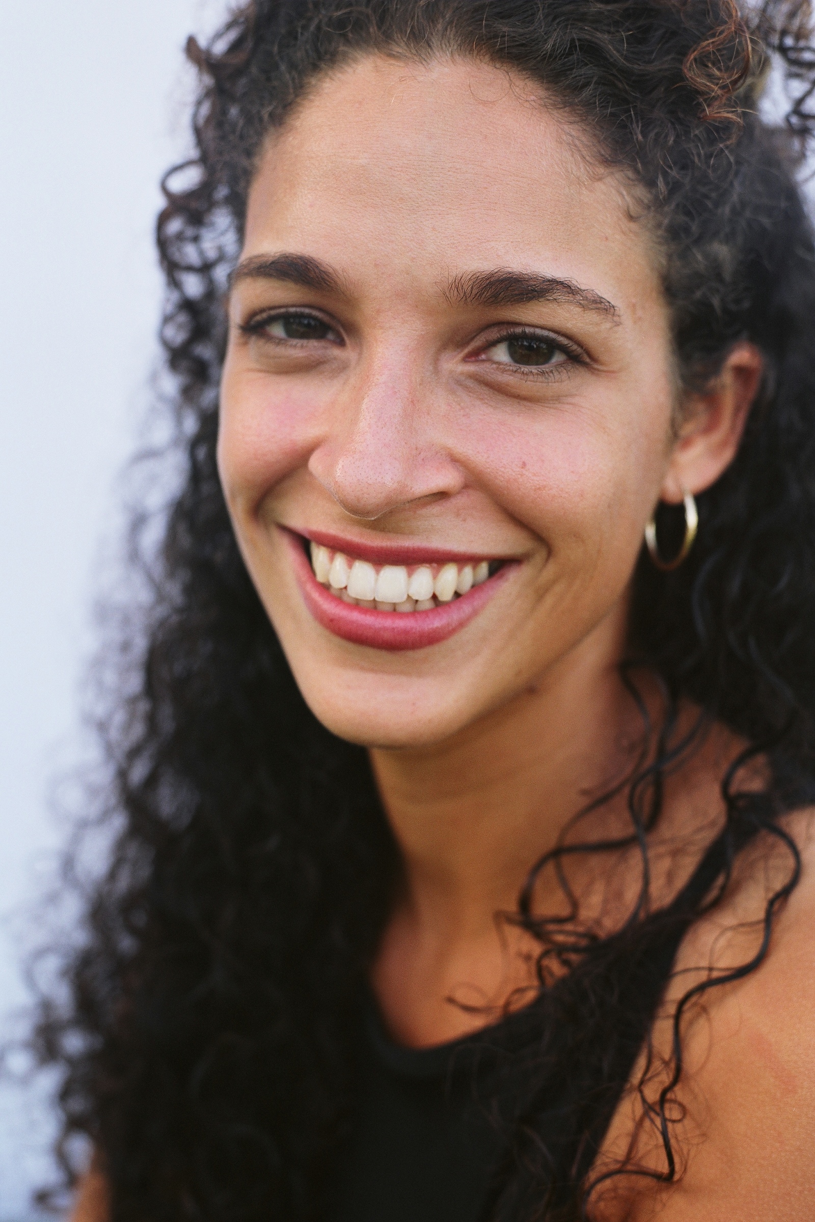 Enhance Your Smile And Rejuvenate Your Self Confidence With Botox And Dermal Fillers In