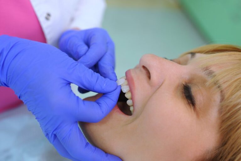Will Getting Veneers Make My Teeth Sensitive? - Boston Smile Center Blog