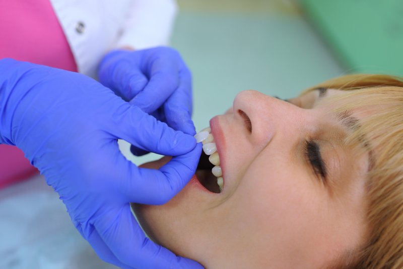 Will Getting Veneers Make My Teeth Sensitive? - Boston Smile Center Blog